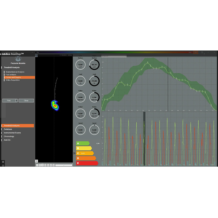 Freestep software de baropodometría - Sensor Medica